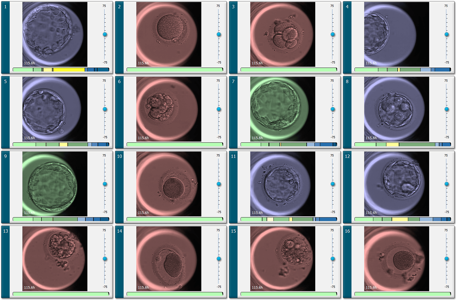 How traditional grading, PGT and time-lapse complement each other
